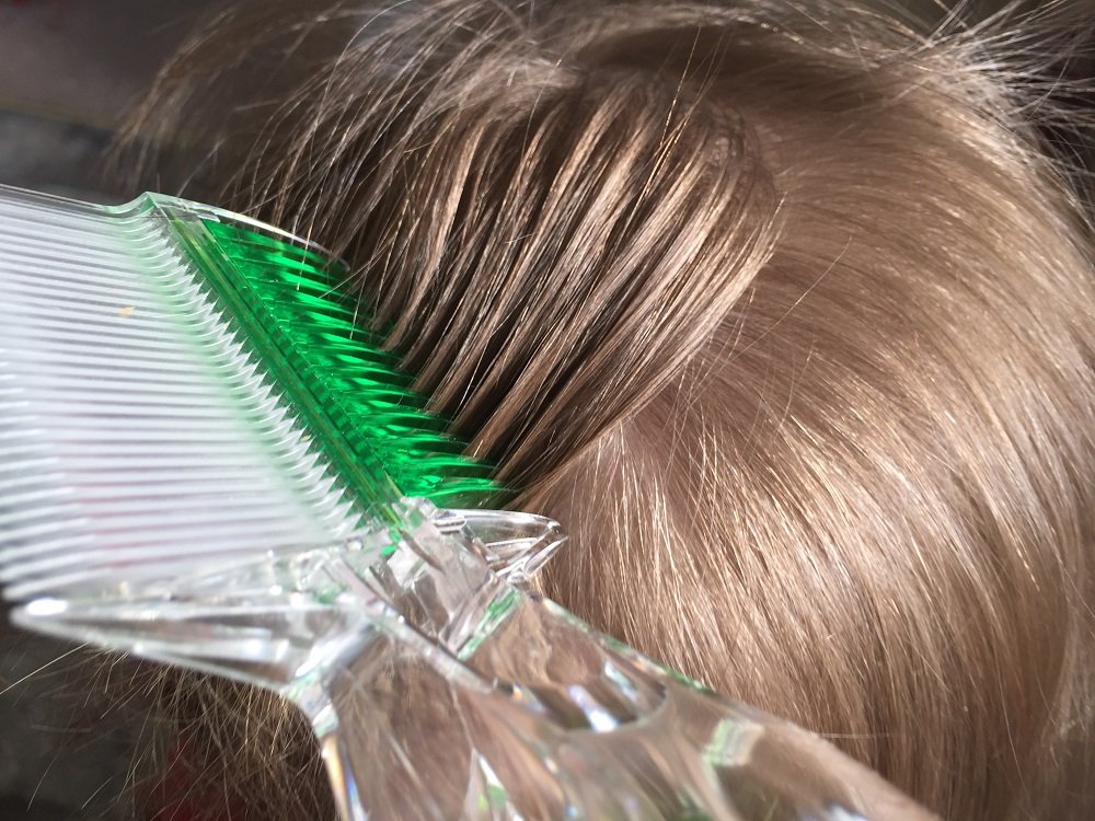 Head Lice Prevention and Treatment, Without Toxic Chemicals | Gale & Plum